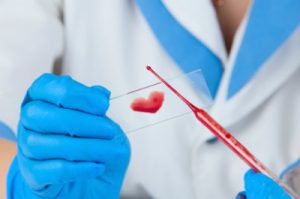 CHCM Bajo: Que Significa, Síntomas, Tratamiento y Prevencion - AEDN