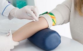 HCM alto: ¿Qué Significa en un Análisis de Sangre - AEDN