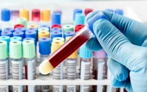 Leucocitos Altos en Sangre. Qué Significa en Análisis de Sangre - AEDN